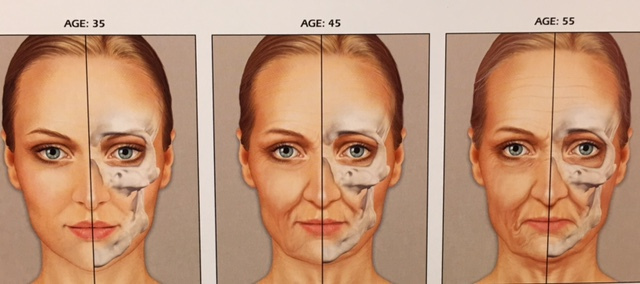 Resorbtia oaselor fetei si cum o stopam – Skin Clinic